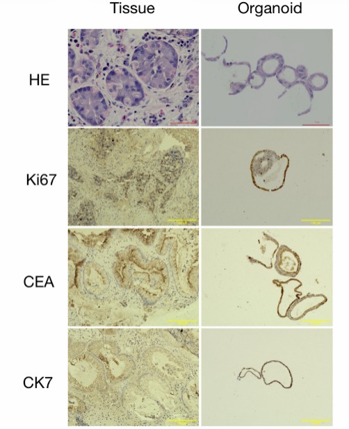 Organoid Construction & Characterization Services - CD Bioparticles