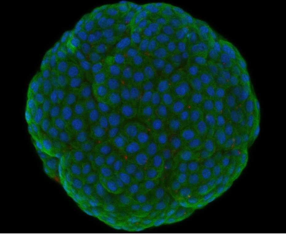 Precise Organoid Construction and Characterization for Drug Discovery ...