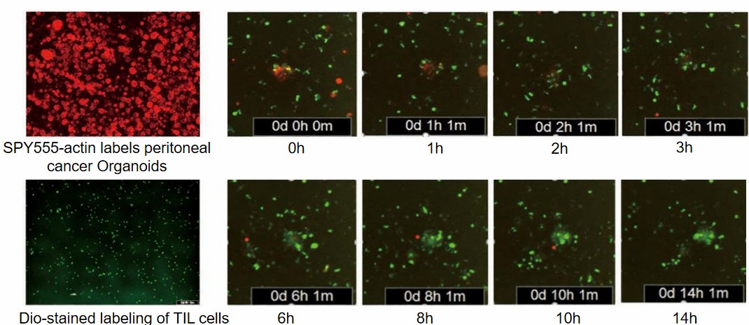 Tumor Organoid & Immune Cell Co-culture Service - CD Bioparticles